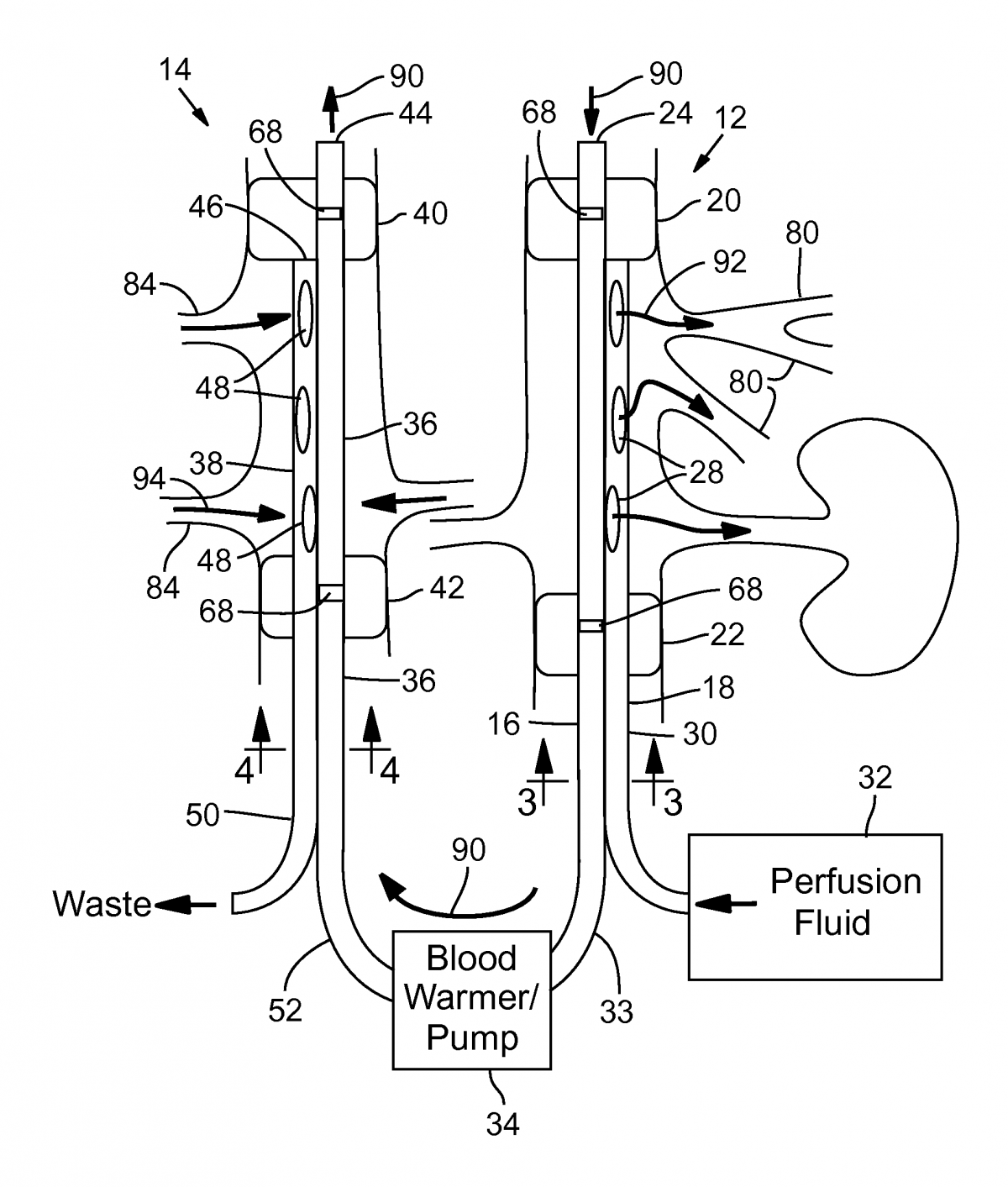 Endovascular Apparatus For Perfusing Organs In A Body – The McGowan ...