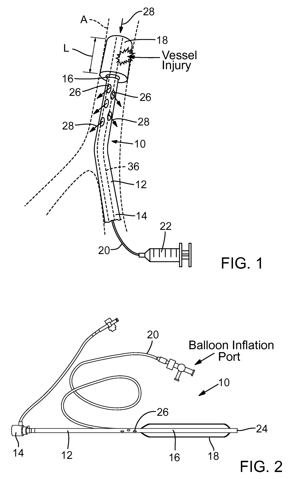 Perfusion Device For Treating An Injured Blood Vessel (2) – The McGowan ...