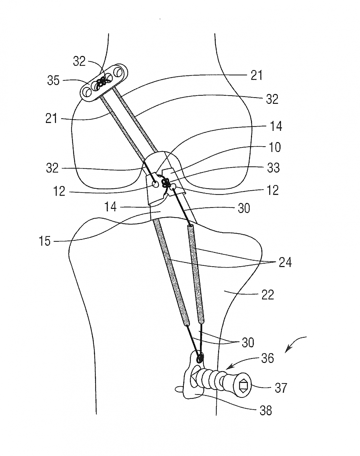 Apparatus And Method For Regeneration Of Ligaments And Tendons – The ...