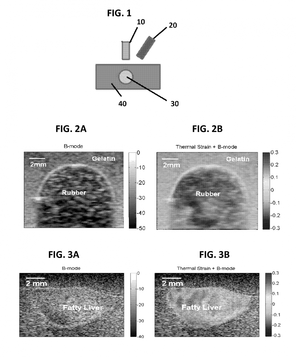 Method And Apparatus To Detect Lipid Contents In Tissues Using ...