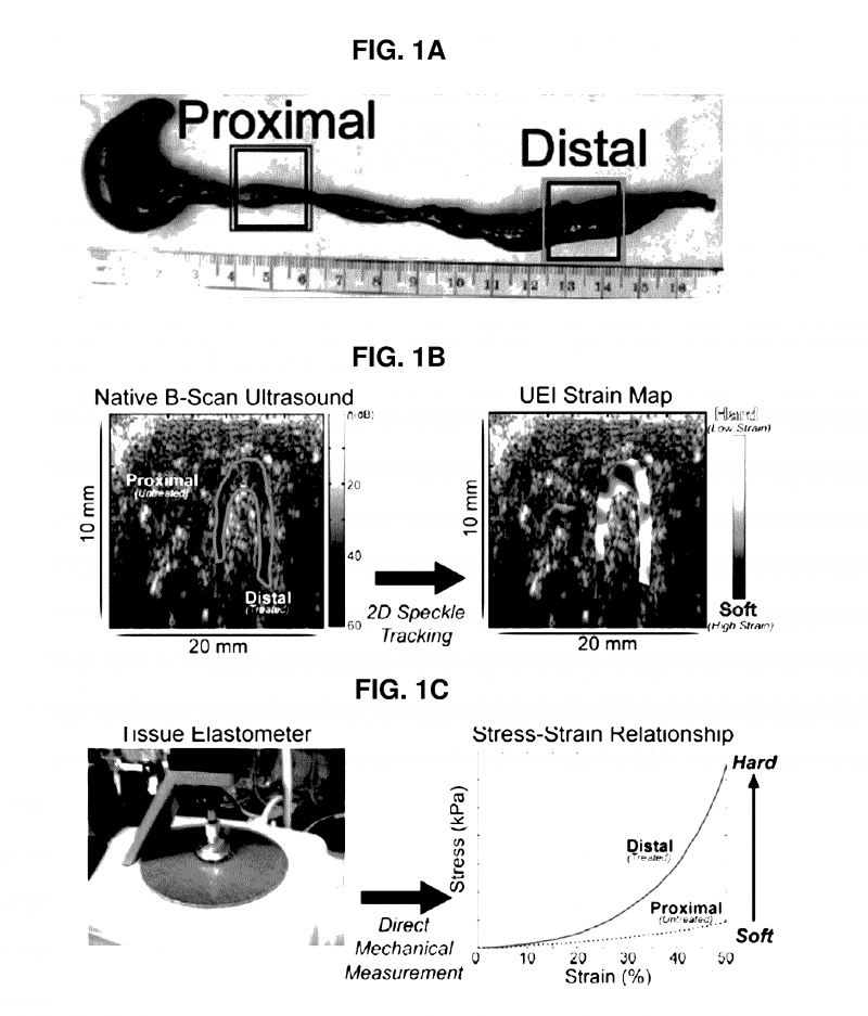 Methods And Apparatuses For Measuring Tissue Stiffness Changes Using ...