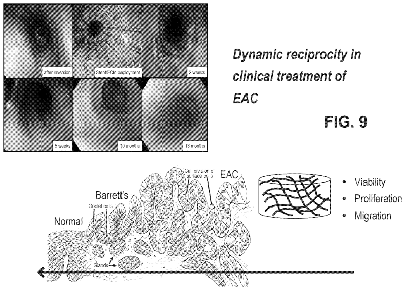 ECM hydrogel for treating esophageal inflammation – The McGowan ...
